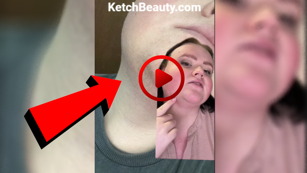 IPL Hair Removal for Trans Women | At-Home MTF Guide & Devices ...